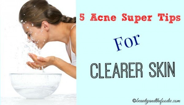 Five Acne Super Tips For Clearer Skin - Beauty and the Foodie